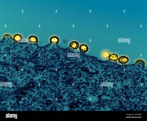 Colorized Transmission Electron Micrograph Of Hiv 1 Virus Particles Yellow Budding And