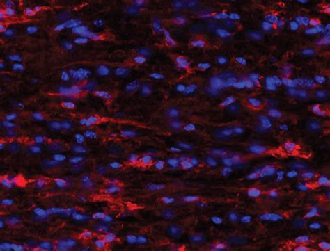 Macrophagemicroglia Within The Optic Nerve Ac Iba 1 Red And Download Scientific Diagram