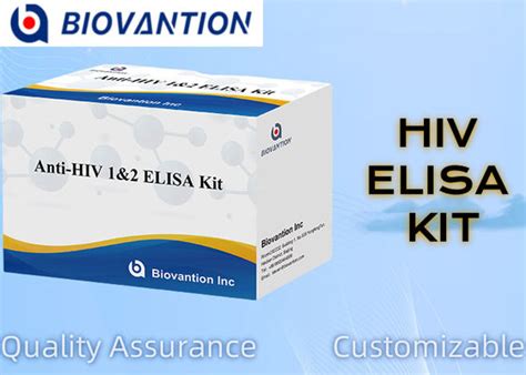 Elisa Test Hiv