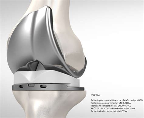 Tibia Grupo Ovic Ltda