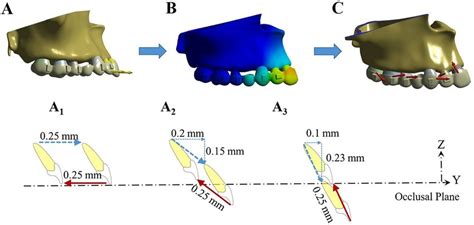 Loading Method Of The Finite Element Model To Simulate Incisor