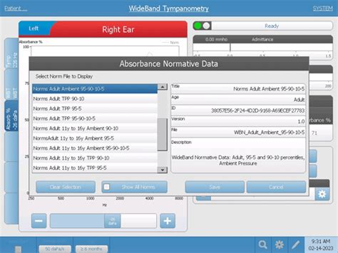 Implementation And Interpretation Of Wideband Tympanometry The
