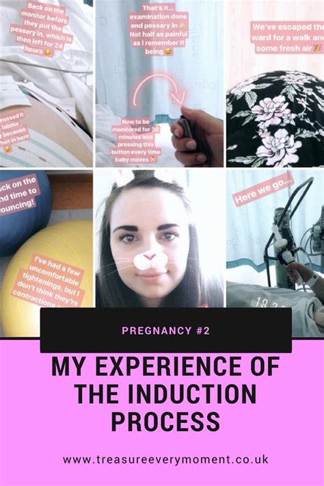 PREGNANCY 2 My Experience Of The Induction Process Treasure Every Moment