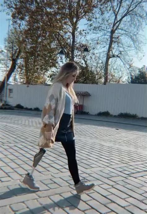 Distantlimbs Ascotfan A Relatively New RAK Amput Tumbex