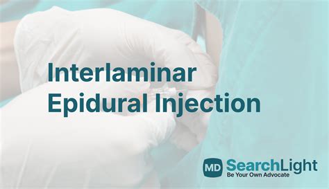 Interlaminar Epidural Injection Epidural Steroid Injection Md