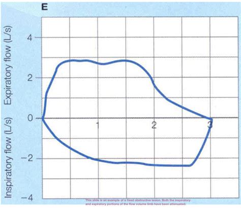 Pulmonary Function Tests Flashcards Quizlet