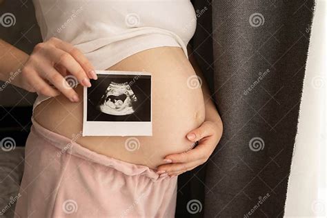 A Pregnant Woman With An Ultrasound 3d Image Medical Supervision