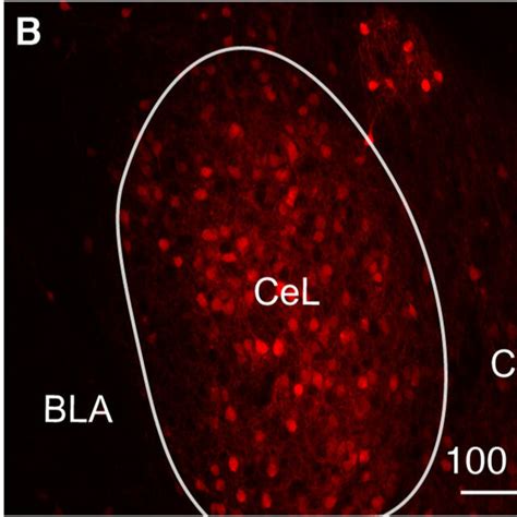 Identifying Sst Neurons In The Cel For Whole Cell Electrophysiology A Download Scientific