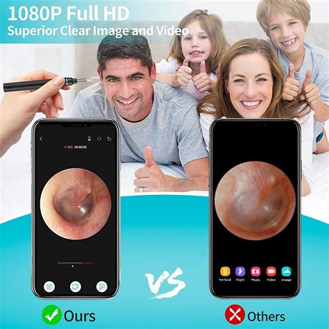 Fojoc Wireless Otoscope Ear Wax Remover Kit 39mm Visual Camera