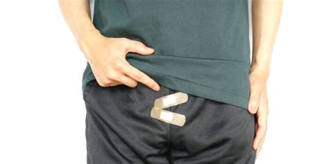 Sexe F Minin Comment Soigner Un Bouton Sur Les Parties Intimes Et Les Grandes L Vres A M