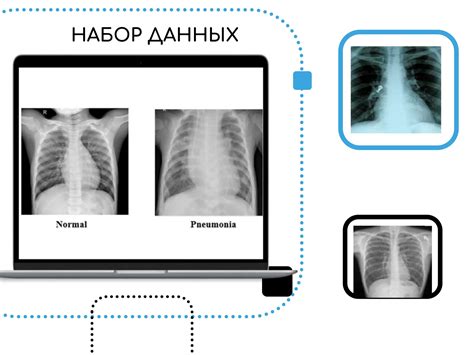 pneumonia classification program development using neural networks based on x ray images pptx