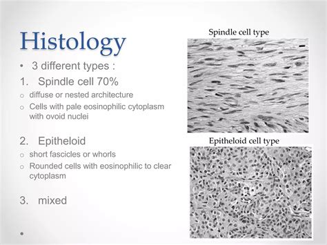 Gastrointestinal Stromal Tumour Gist D1 Ppt