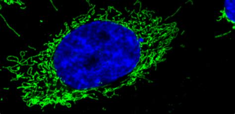 Researchers Identify New Link Between Mitochondrial Dysfunction And The Development Of Copd