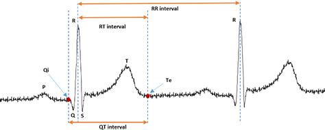 Figure 1 From Implementation Of Wavelet Transform Based Algorithms In