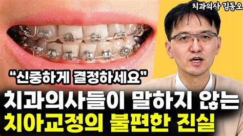 치과의사들이 말하지 않는 치아교정의 불편한 진실 정말 신중하게 결정하세요 L치과의사 김동오6부 Youtube