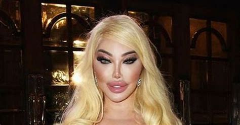 “성형 100회”…어린 여자 보면 불안하다는 女스타의 충격 상태 사진