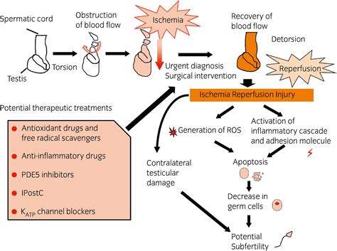 Testicular Torsion Blood Flow At Alonzo Christensen Blog