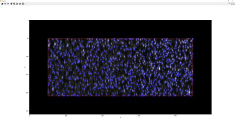 Bug Cell Detection Ignores Borders · Issue 310 · Brainglobe