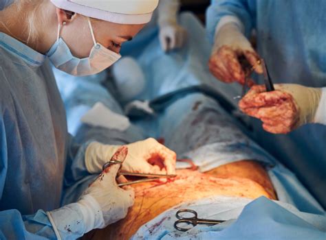 How Long Does A Gynecological Laparoscopy Procedure Take