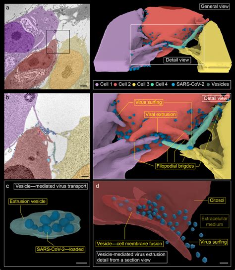 Three Dimensional Reconstruction From 14 Serial Electron Micrographs A