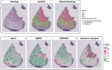 Integration Of Spatial Transcriptomics And Histology Images By Joey Xy Medium