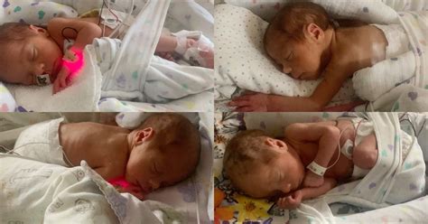 Minnesota Couple Welcome Rare Identical Quadruplet Girls