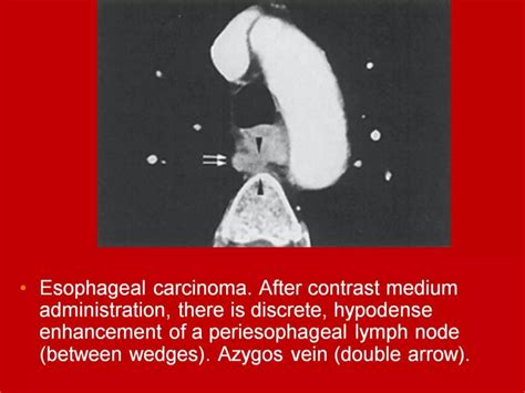 Whole Body Computed Tomography Git Pptx Obscenity And Profanity Sensitive Topics