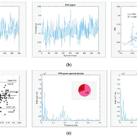 The Analysis Before La With Ppg And Ecg Measurements A Ppi Plot In