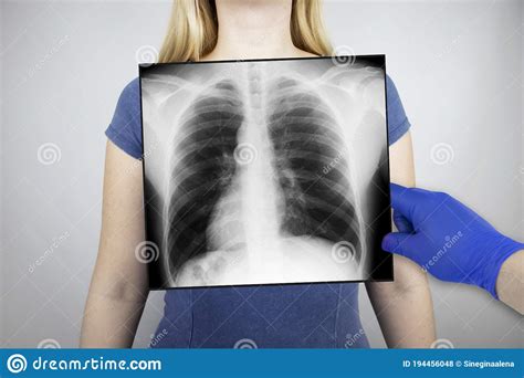 X Ray Of The Chest Of A Woman A Doctor Radiologist Is Studying An X Ray Examination A Picture
