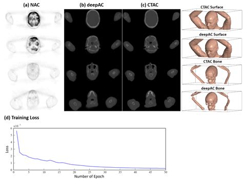 Artificial Intelligence Intelligent Imaging Innovation And