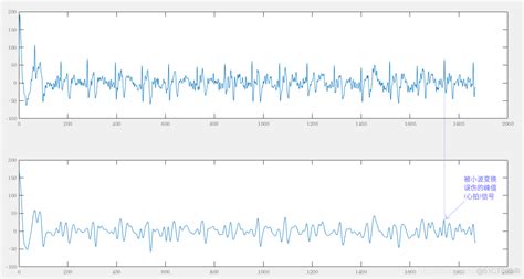 Python 心电信号处理 心电信号处理实验报告mob6454cc6ff2b9的技术博客51cto博客