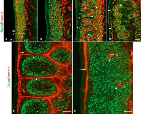 Development Of The Reproductive System Clinical Tree