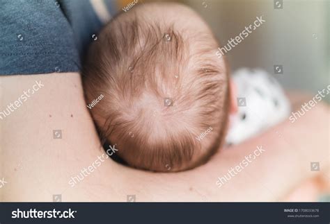 Infant Scalp Images Stock Photos Vectors Shutterstock