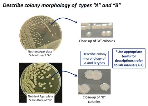 Bacillus Subtilis Colony