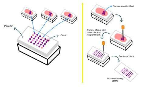 Tissue Microarray An Innovative Diagnostic And Research Tool Mymab