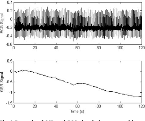 Figure 3 From An Accurate Emotion Recognition System Using Ecg And Gsr