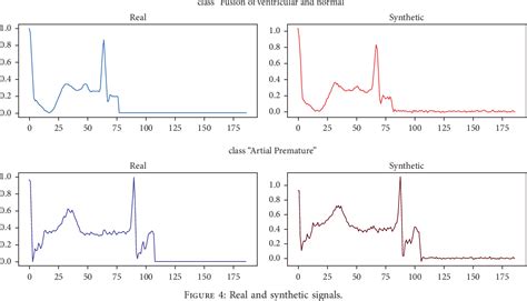 Figure 4 From Classification Of Arrhythmia In Heartbeat Detection Using Deep Learning Semantic