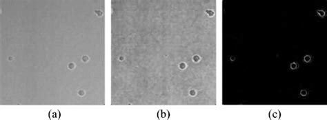 The Image After Median Filtering B The Image After Adaptive Histogram