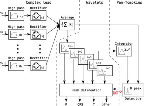 Block Diagram Of The Complex Pan Tompkins Wavelets Algorithm It Uses A