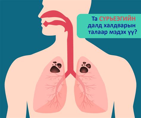 Далд сүрьеэг хэрхэн илрүүлэх вэ