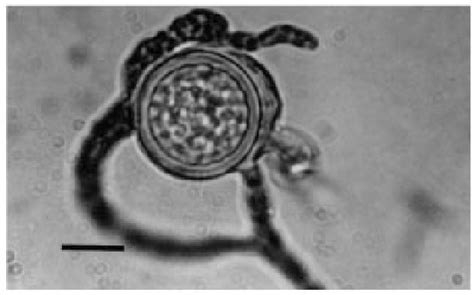 Aplerotic Oospore Of Pythium Sulcatum Showing Characteristic Furrowed Download Scientific