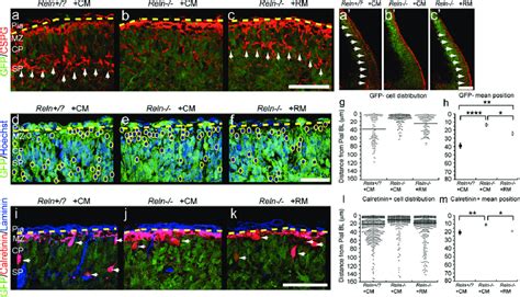 Evidence Of Partial Preplate Splitting 4 H After Reelin Injection Download Scientific Diagram
