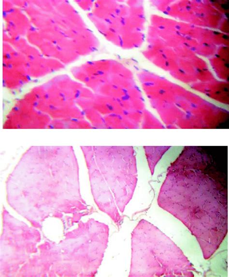Corte Histológico Transversal De Musculo A Los Treinta Días De Aplicado