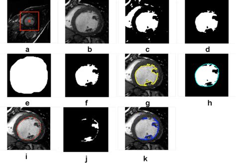 Lv Contour Calculation Procedure A Image With Rectangular Roi And Download Scientific Diagram