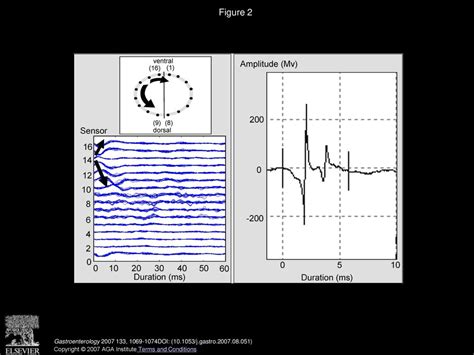 Recent Advances In Assessing Anorectal Structure And Functions Ppt Download