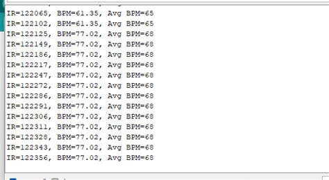 Connect Esp32 To Max30102 Heart Rate And Spo2 Sensor Guide Soslab