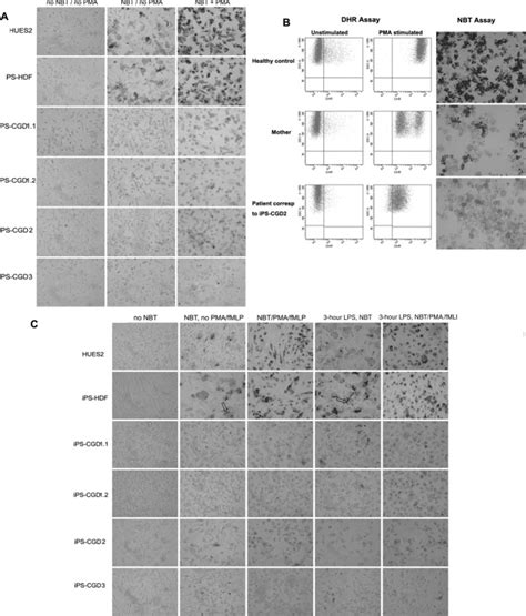 Production Of Ros In Control And Cgd Ipsc Derived Monocytes A Download Scientific Diagram