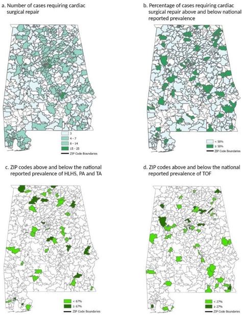 Zip Code Map Alabama