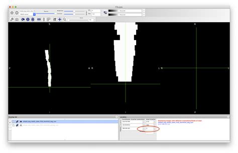 Morphometric Values Are Reported In Slices That Are Not Segmented