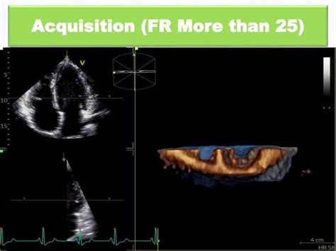 Lv Systolic Functionpptx 3 D Graphics Computer Software And Applications